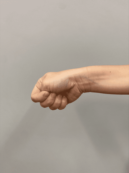 A Guide to Visiting the Hand Doctor | Common Hand Conditions